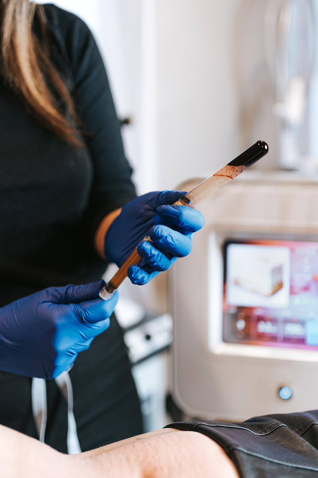 Platelet Rich Plasma - MD Esthetics